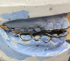 An Alternative to Current Orthodontic Retention Appliances | Biores ...